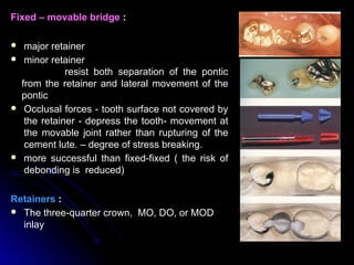 Indications Contraindications and Classification of Bridges 2.pptx