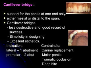 Indications Contraindications and Classification of Bridges 2.pptx