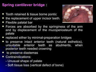 Indications Contraindications and Classification of Bridges 2.pptx