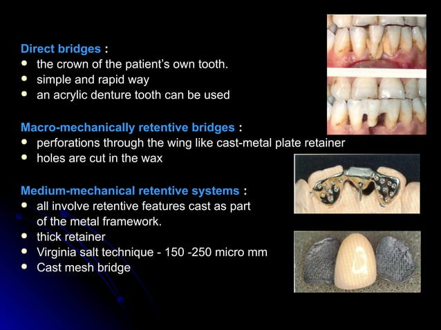 Indications Contraindications and Classification of Bridges 2.pptx