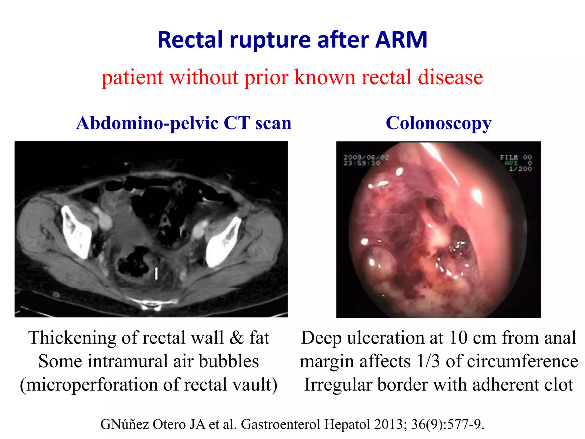 Indications, examination protocol & results of conventional anorectal ...