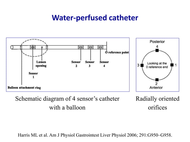 Indications, examination protocol & results of conventional anorectal manometry | PPTX