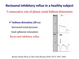 Indications, examination protocol & results of conventional anorectal ...