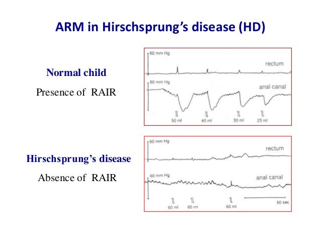 Indications, examination protocol & results of conventional anorectal…