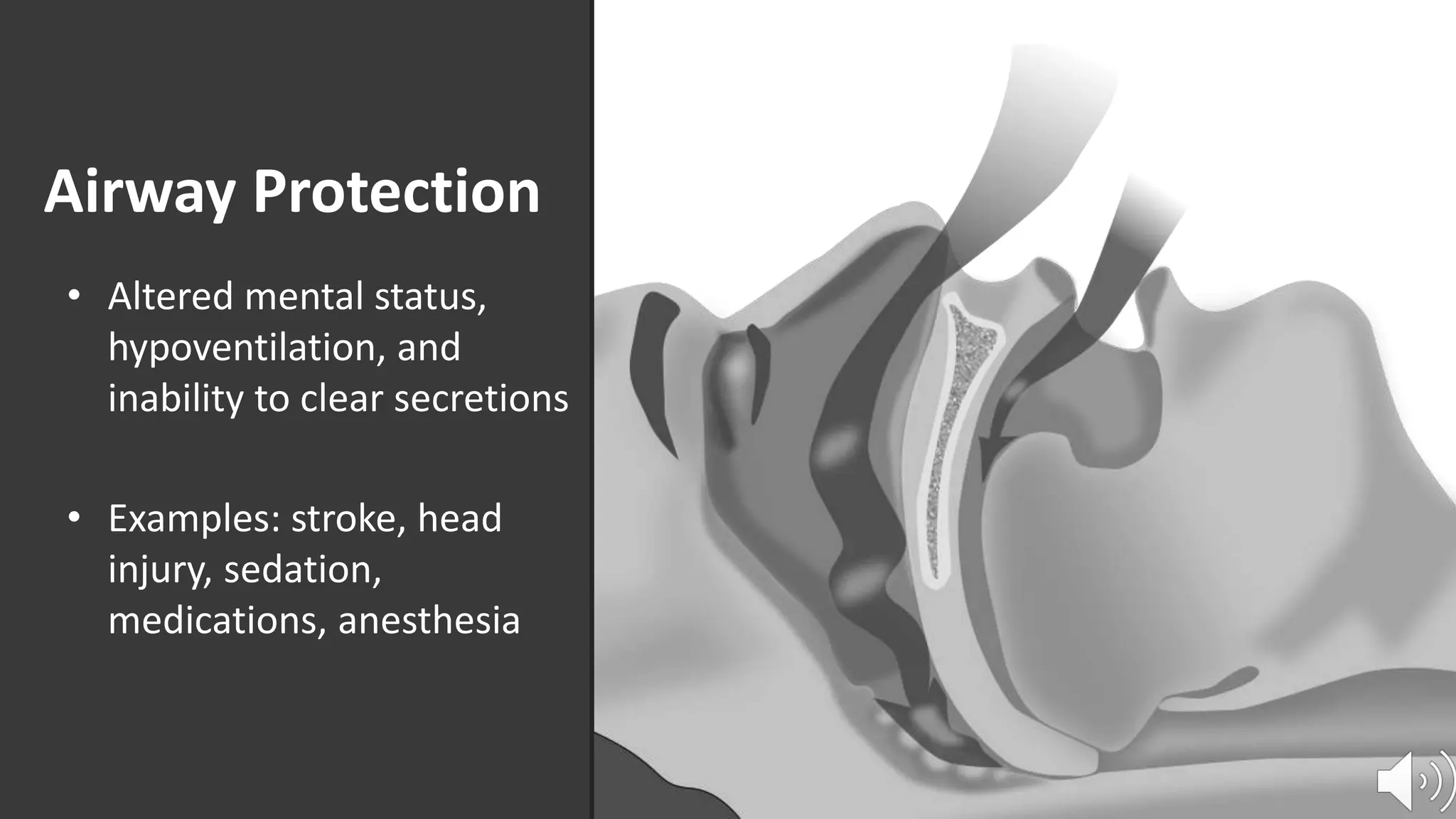 Indications for Intubation and Mechanical Ventilation | PPTX