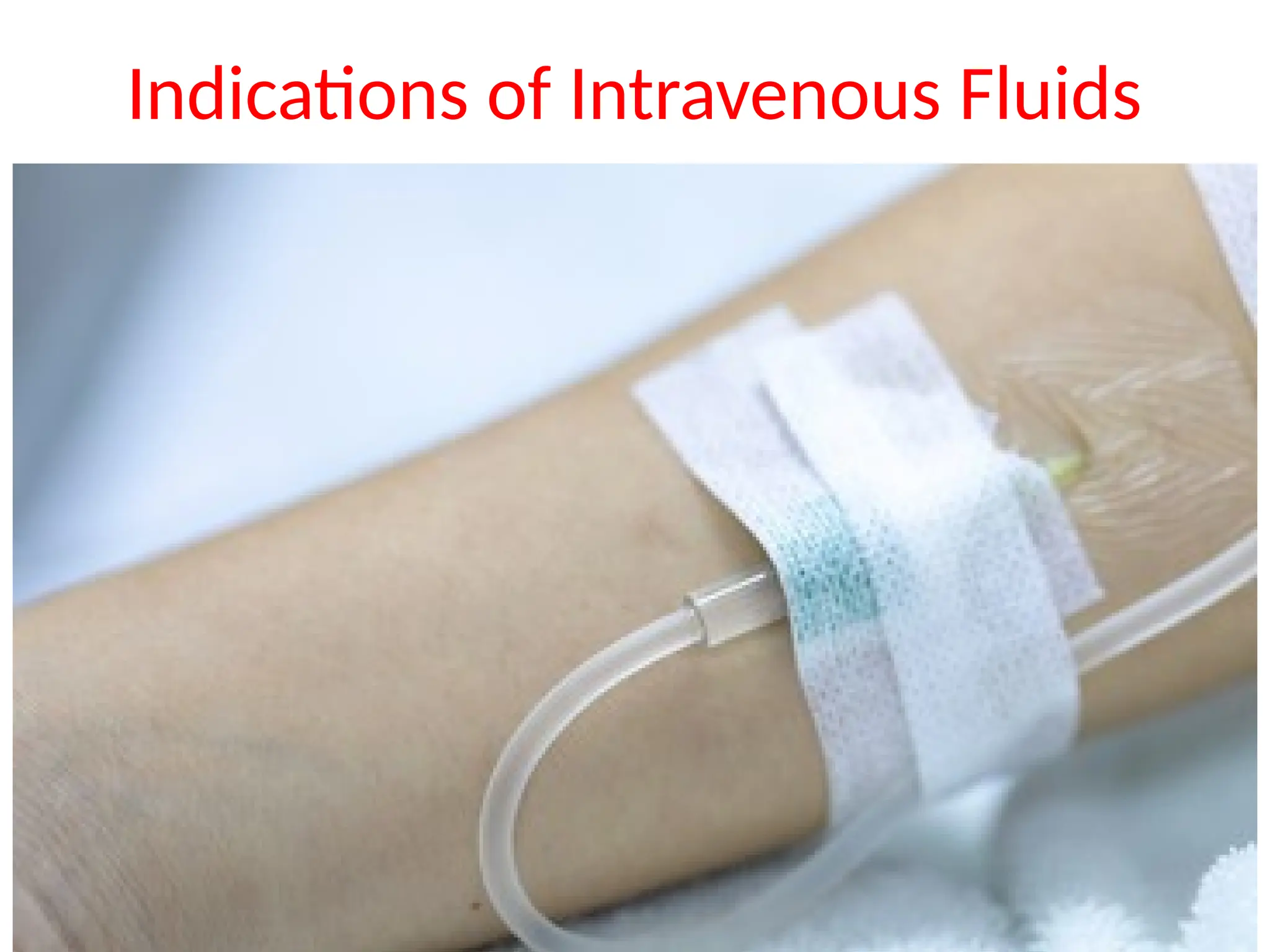 Indications_of_IV_Fluids_Updated-١-1.pptx