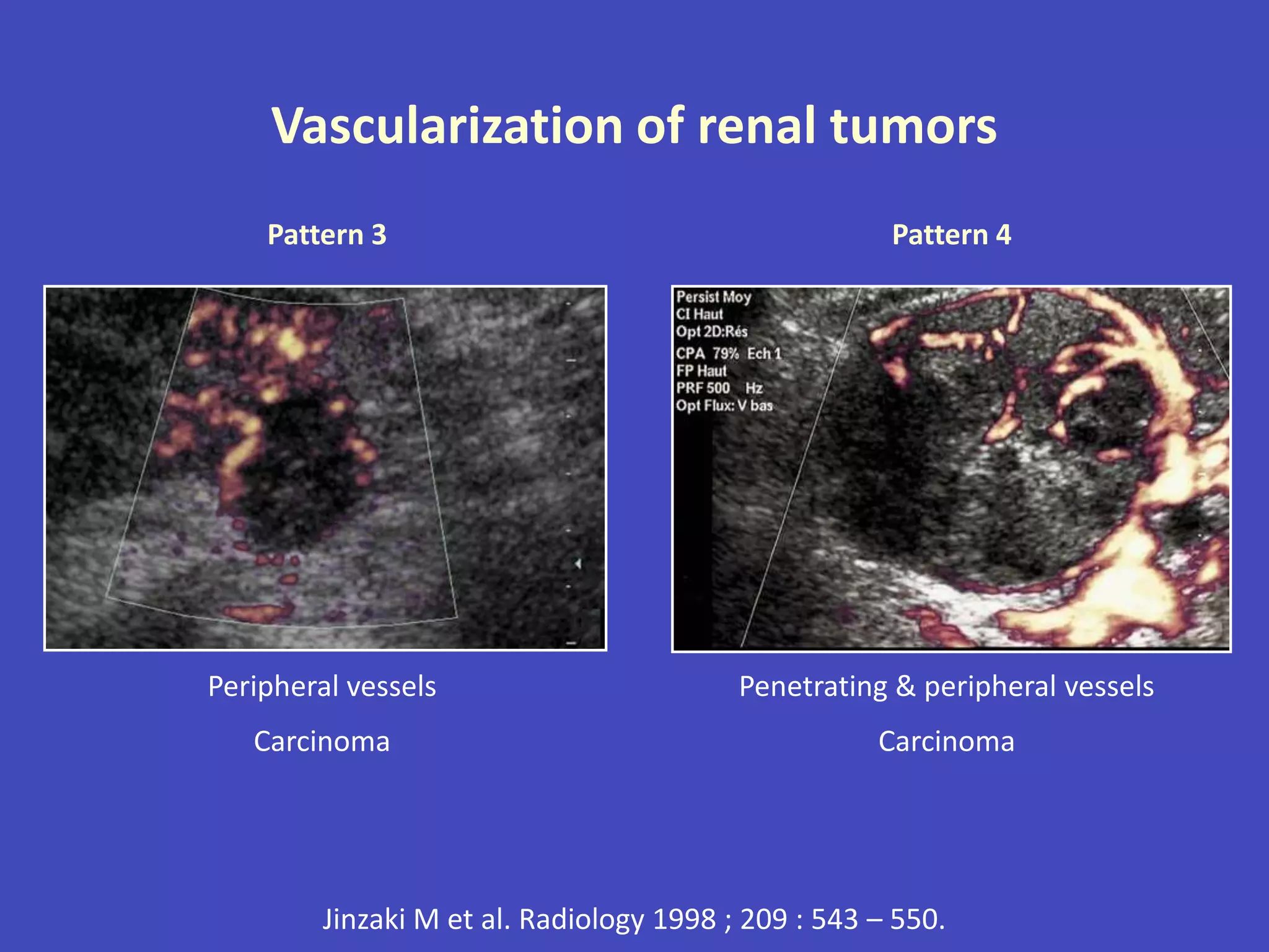 Indications of renal doppler ultrasound 3 | PPTX