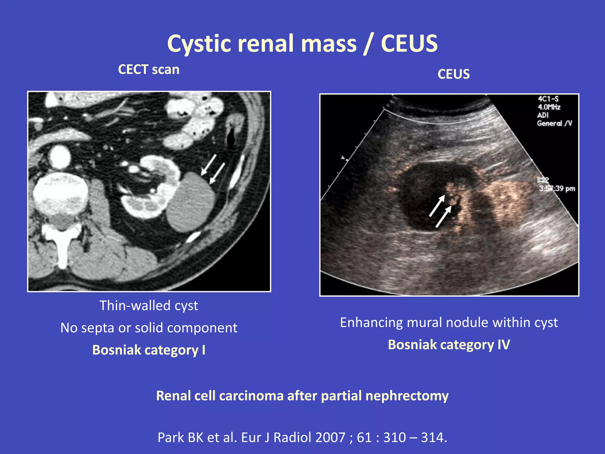 Indications of renal doppler ultrasound 3 | PPTX | Medical Health