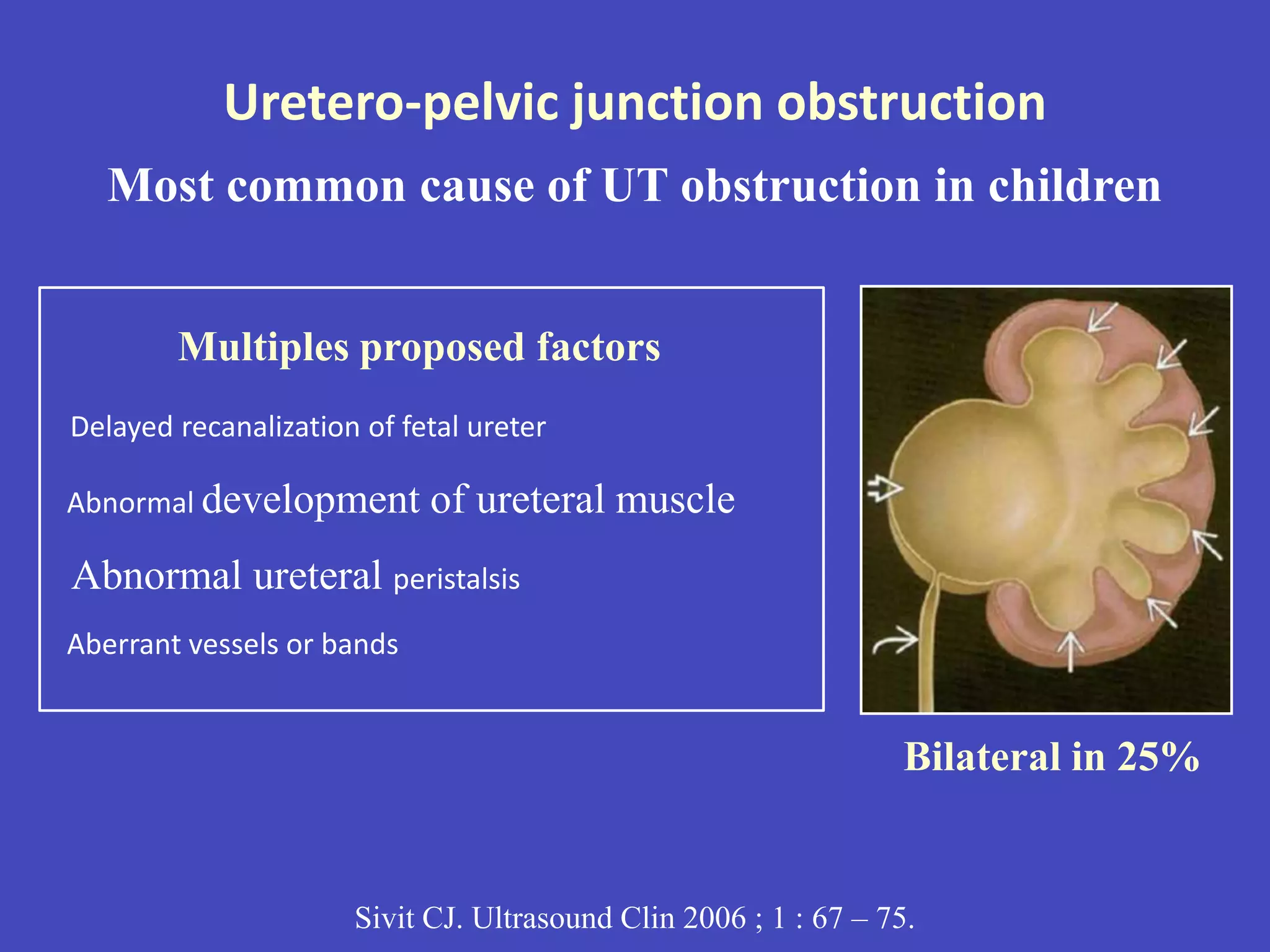 Indications of renal doppler ultrasound 3 | PPTX