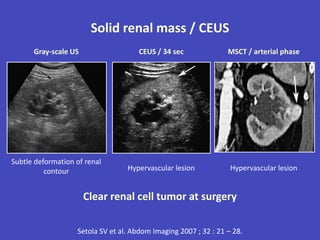 Indications of renal doppler ultrasound 3 | PPTX | Medical Health