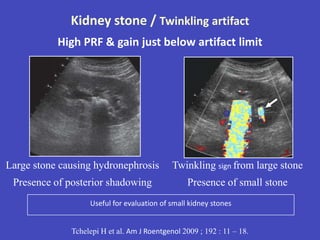 Indications of renal doppler ultrasound 3 | PPTX | Medical Health