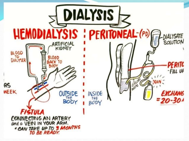 Indications of renal replacement therapy
