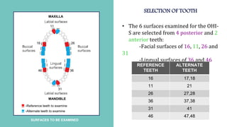 Oral Hygiene Index (OHI) and Oral Hygiene Index-Simplified (OHI-S) | PPTX