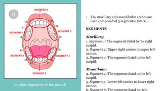 Oral Hygiene Index (OHI) and Oral Hygiene Index-Simplified (OHI-S) | PPTX