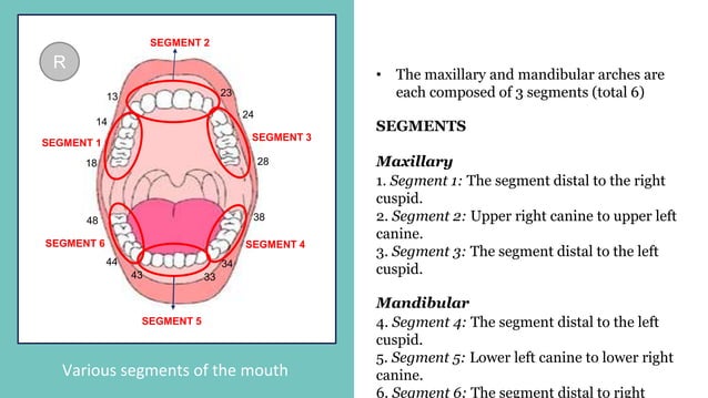 Oral Hygiene Index (OHI) and Oral Hygiene Index-Simplified (OHI-S ...