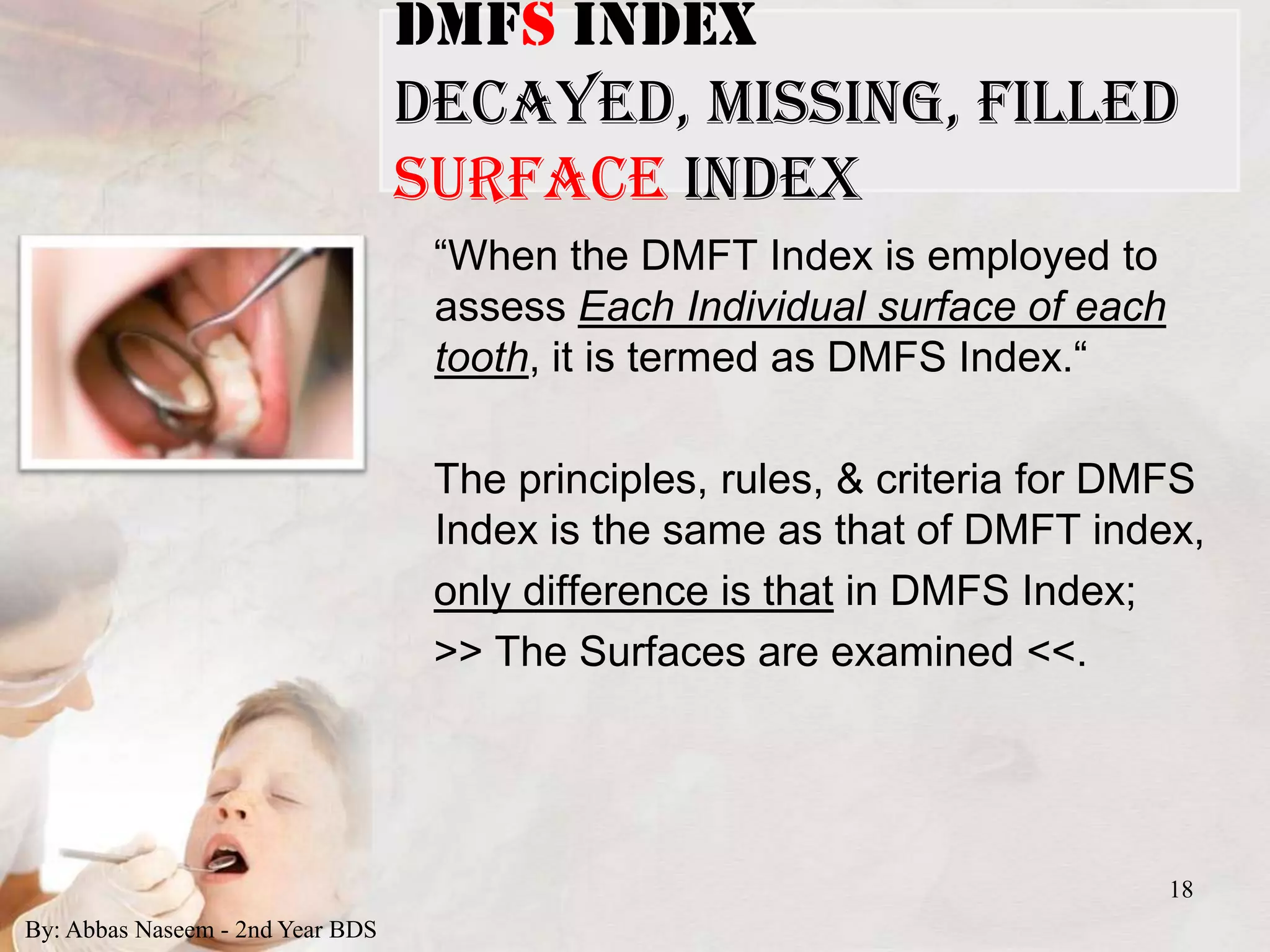 Indices for dental caries | PPTX