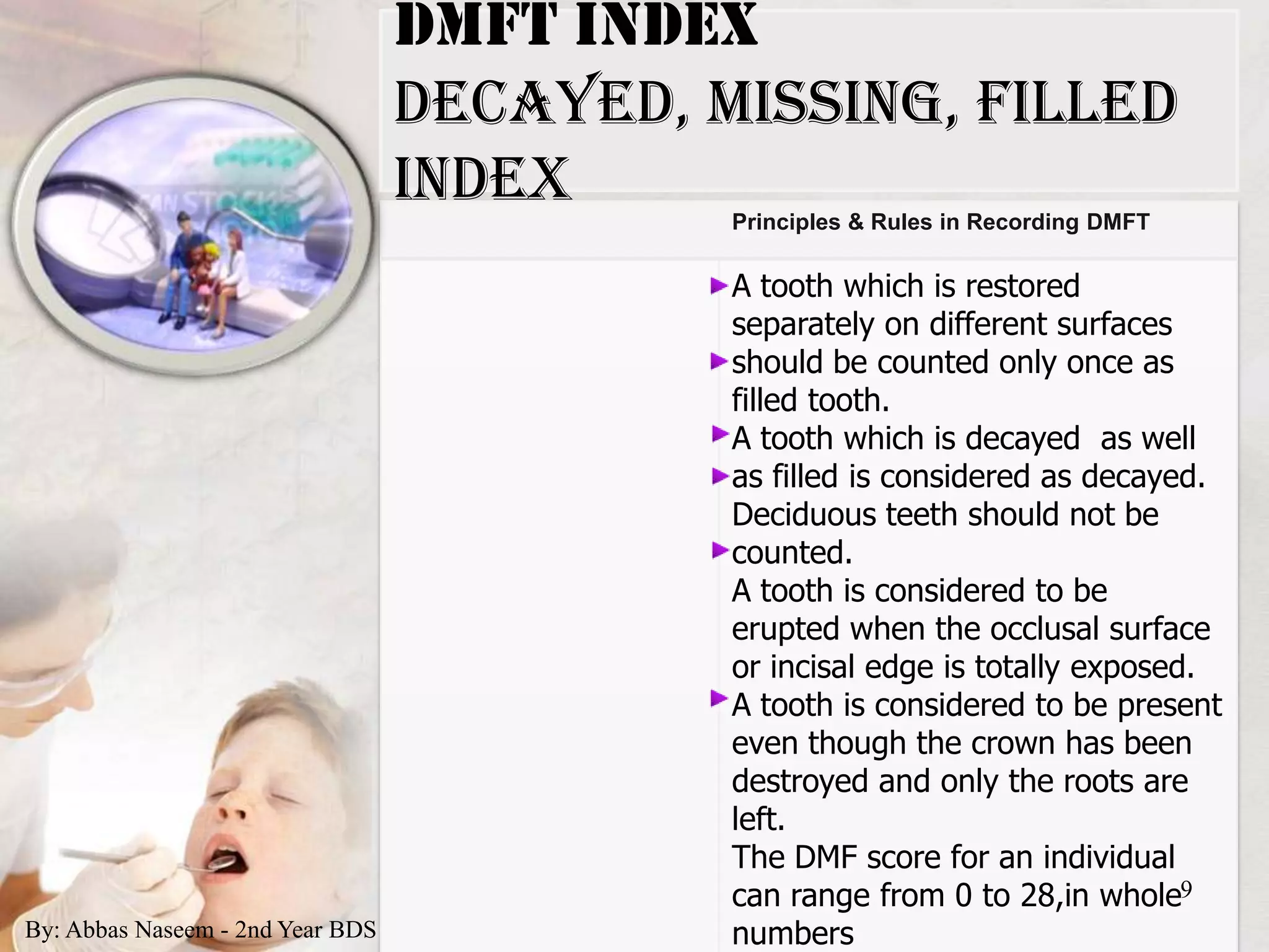 Indices for dental caries | PPTX