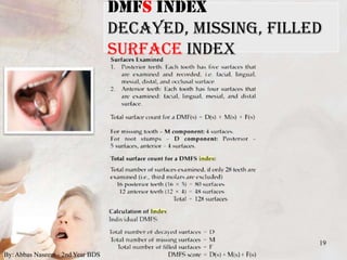 Indices for dental caries | PPTX