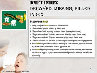 Indices for dental caries | PPTX