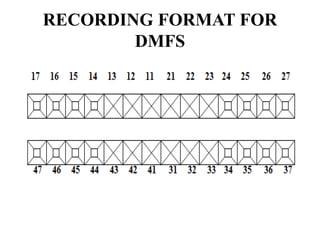 Indices for dental caries | PPT