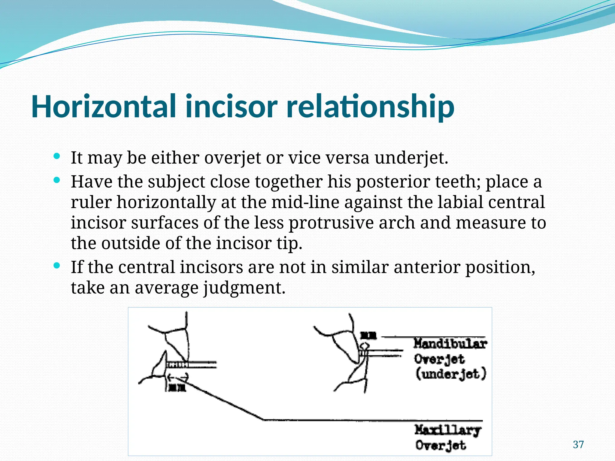INDICES FOR MALOCCLUSION in orthodontics.pptx