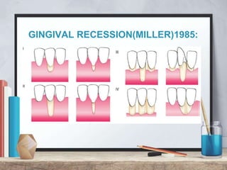Indices in periodontology | PPTX