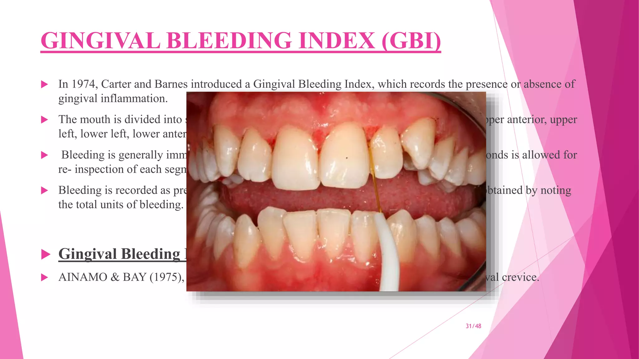INDICES IN PERIODONTOLOGY | PPTX