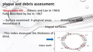Indices used in periodontal destruction | PPTX