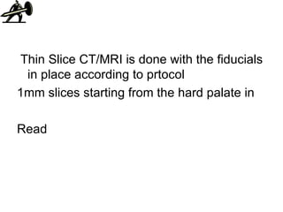 Indigenization Of Fiducials In Image Guided Neurosurgery | PPT