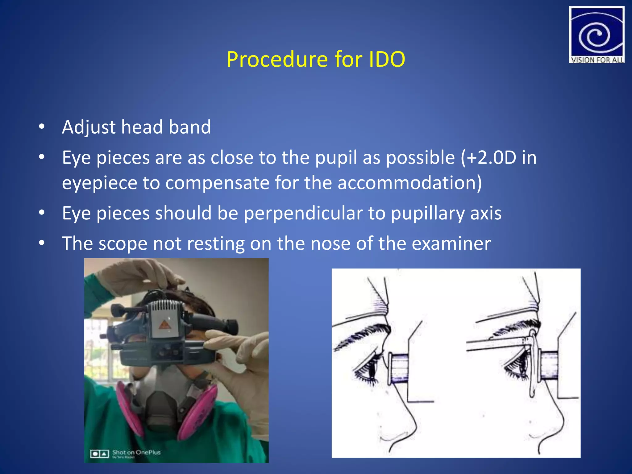 Indirect ophthalmoscopy and fundus drawing | PPTX