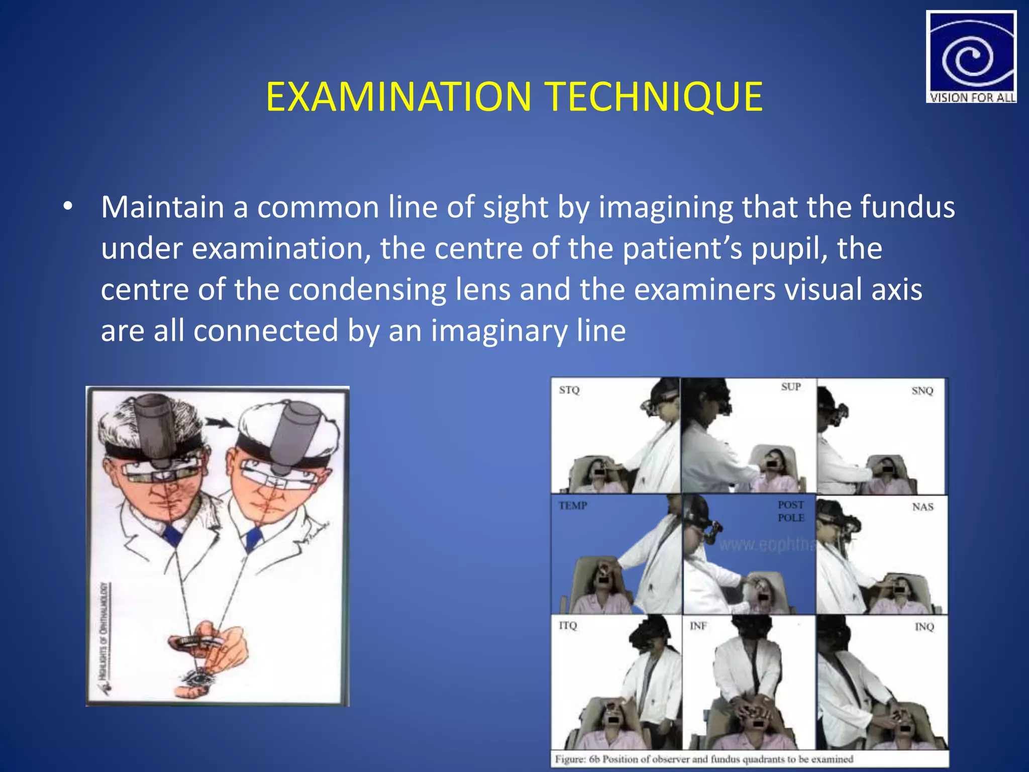 Indirect ophthalmoscopy and fundus drawing | PPTX