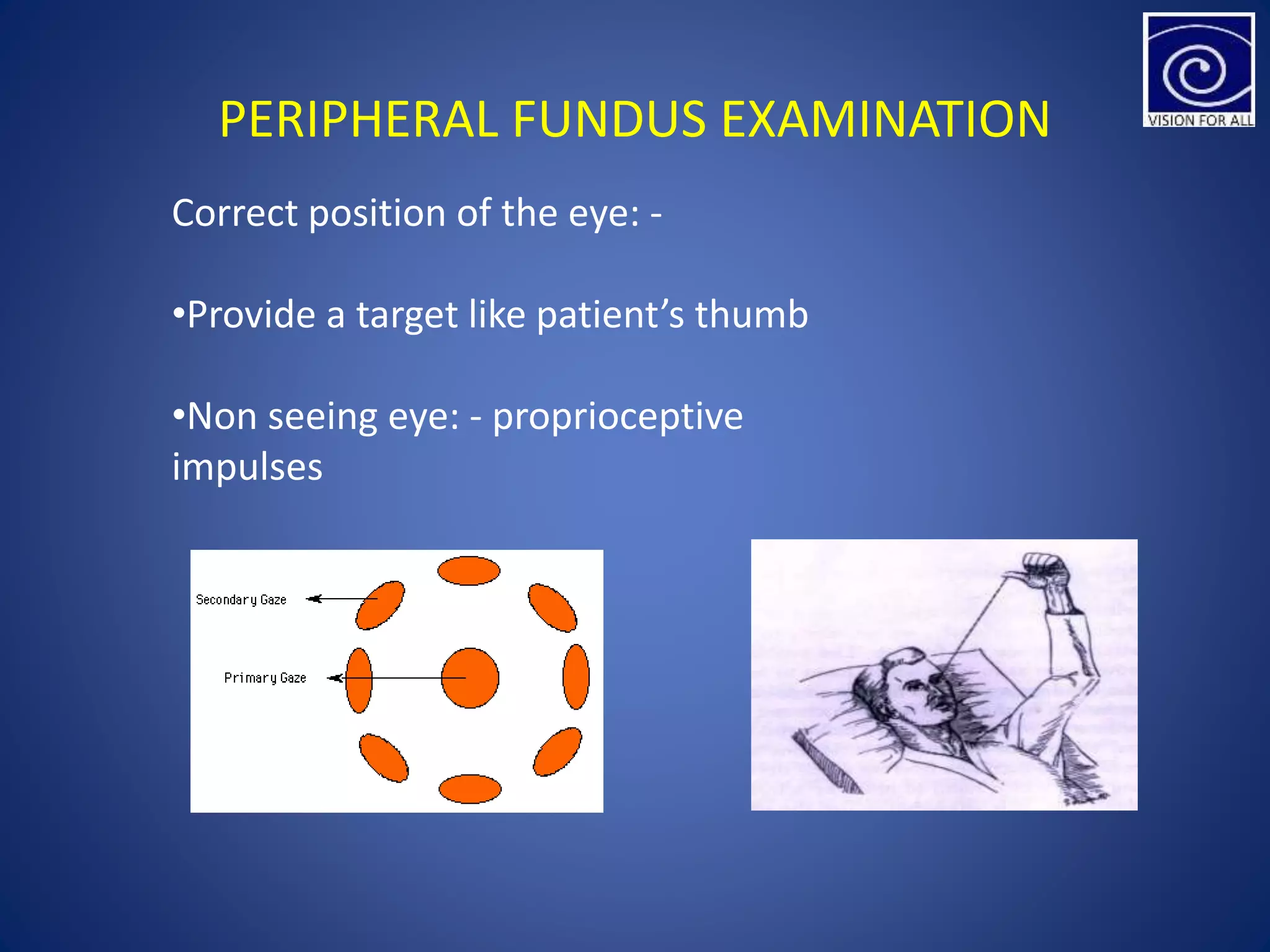 Indirect ophthalmoscopy and fundus drawing | PPTX