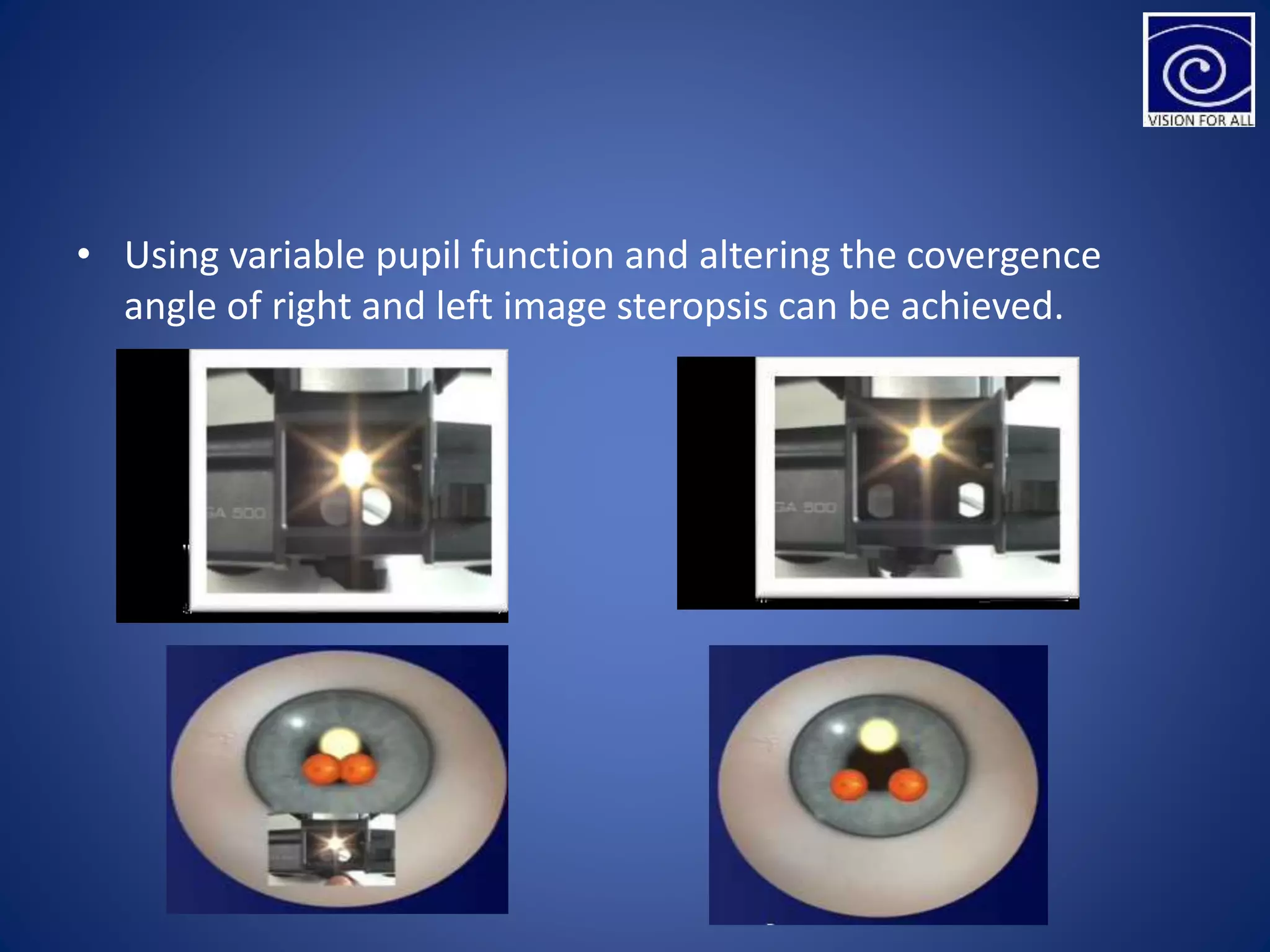 Indirect ophthalmoscopy and fundus drawing | PPTX