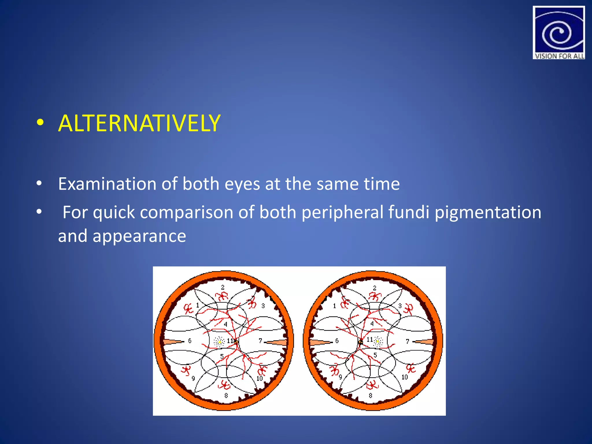 Indirect ophthalmoscopy and fundus drawing | PPTX