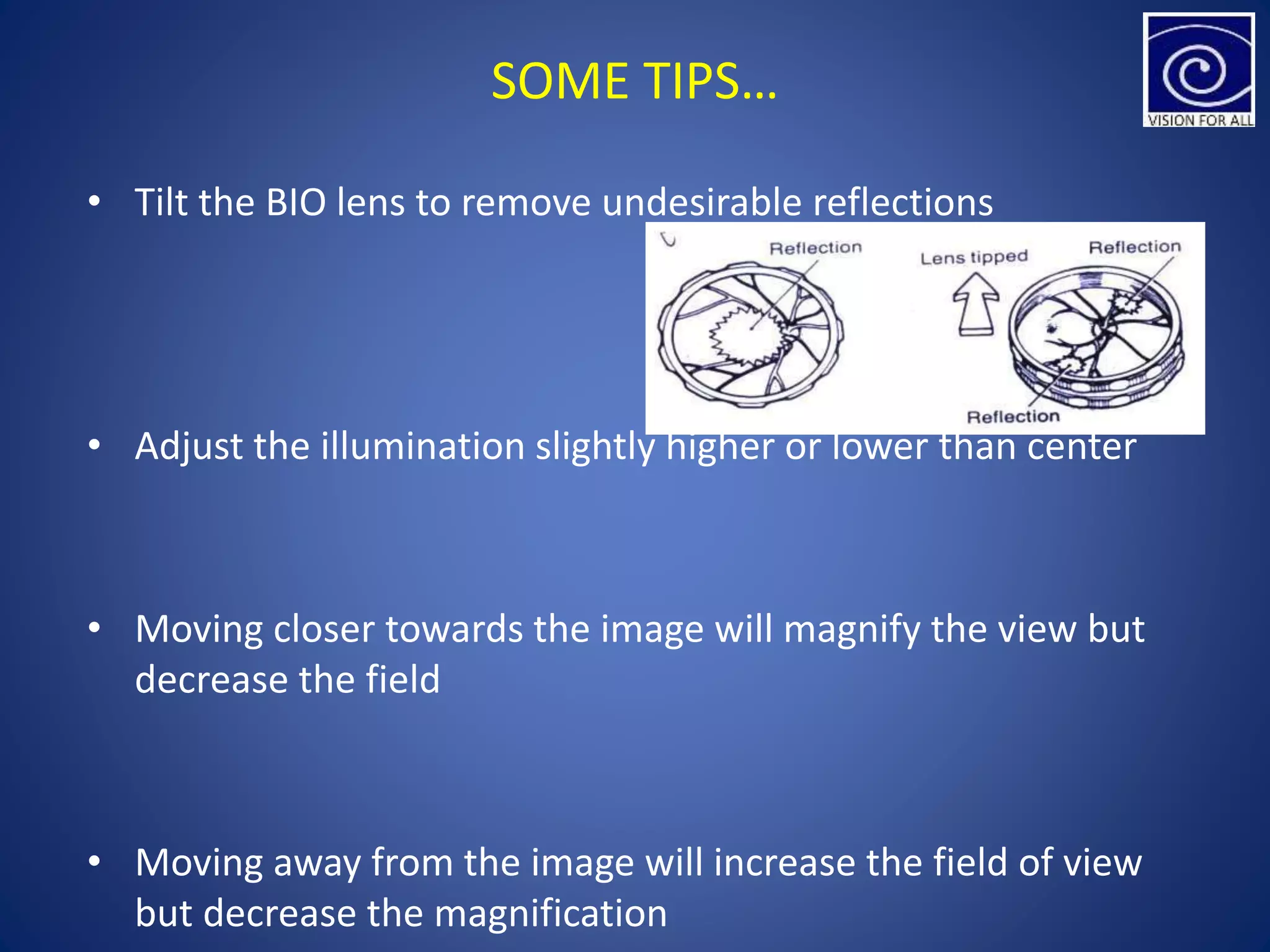 Indirect ophthalmoscopy and fundus drawing | PPTX