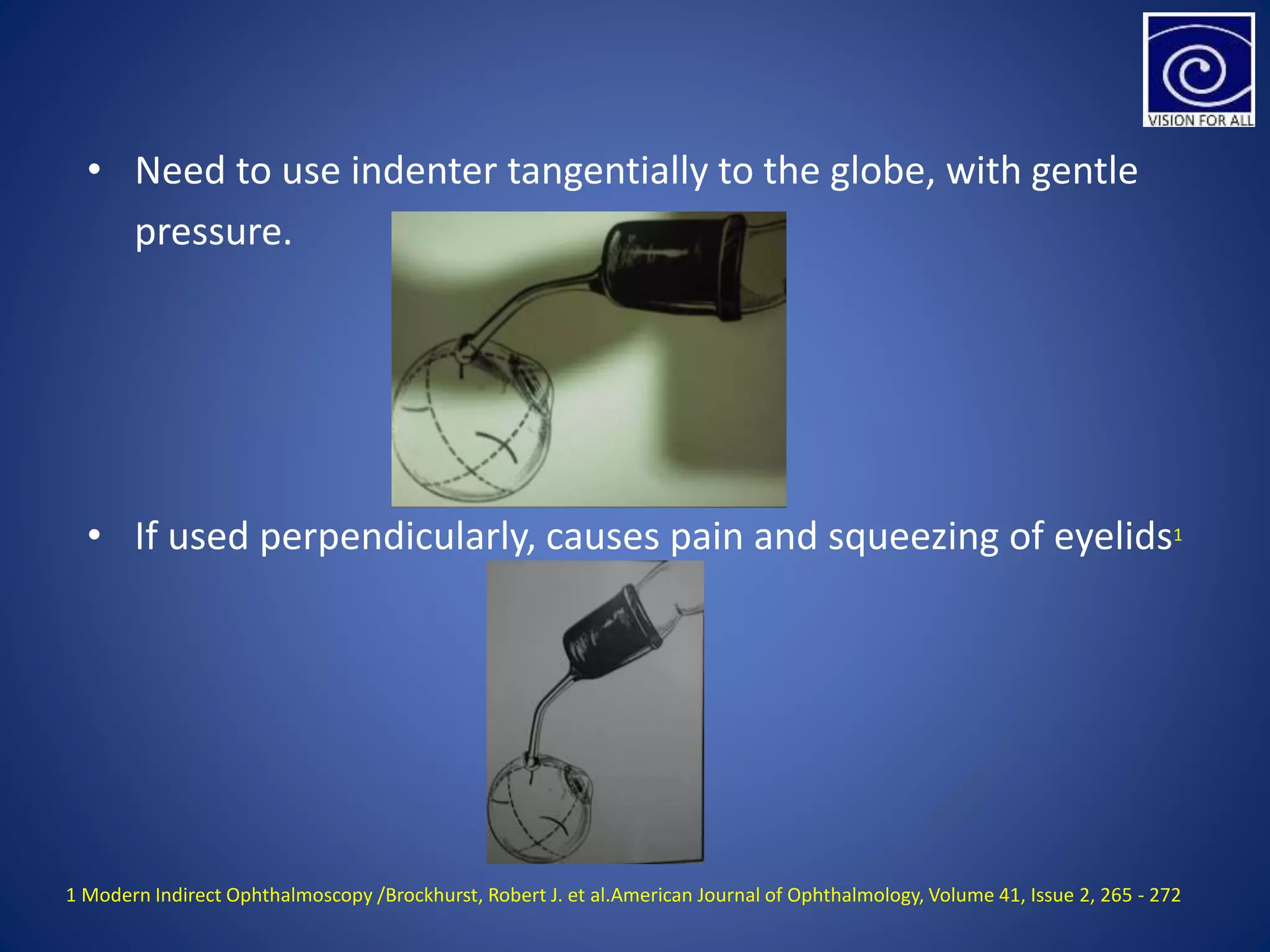 Indirect ophthalmoscopy and fundus drawing | PPTX