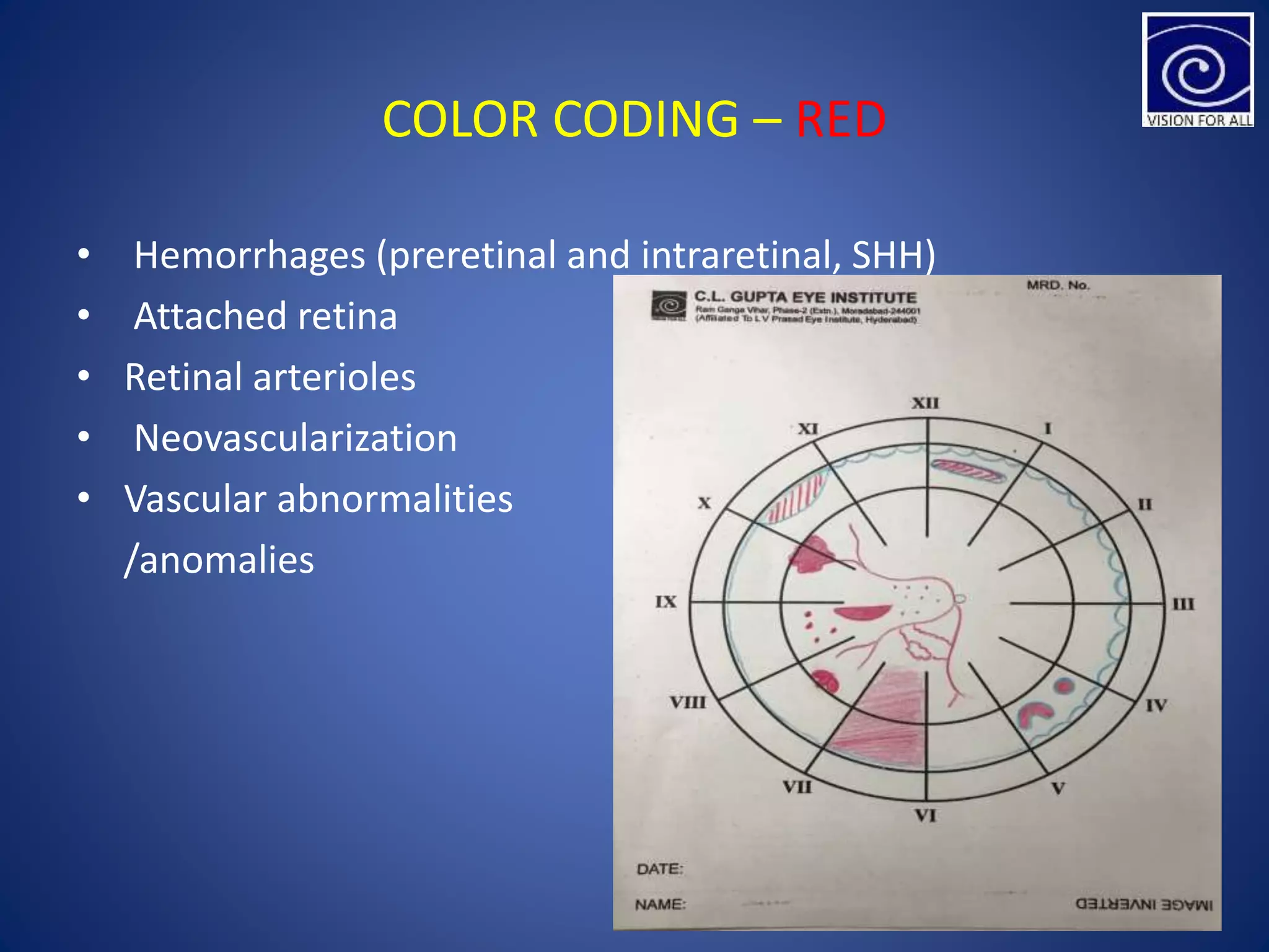 Indirect ophthalmoscopy and fundus drawing | PPTX