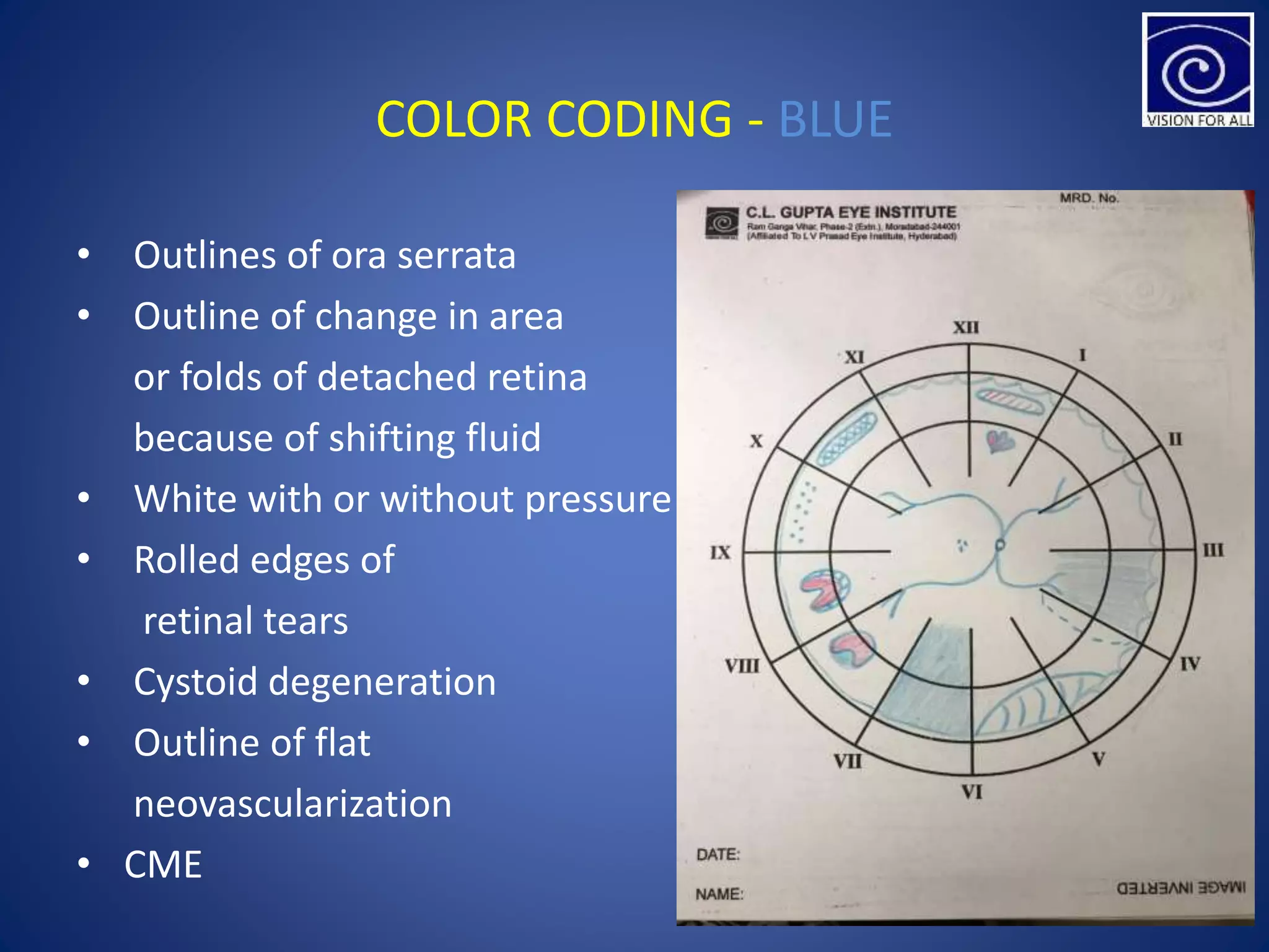 Indirect ophthalmoscopy and fundus drawing | PPTX