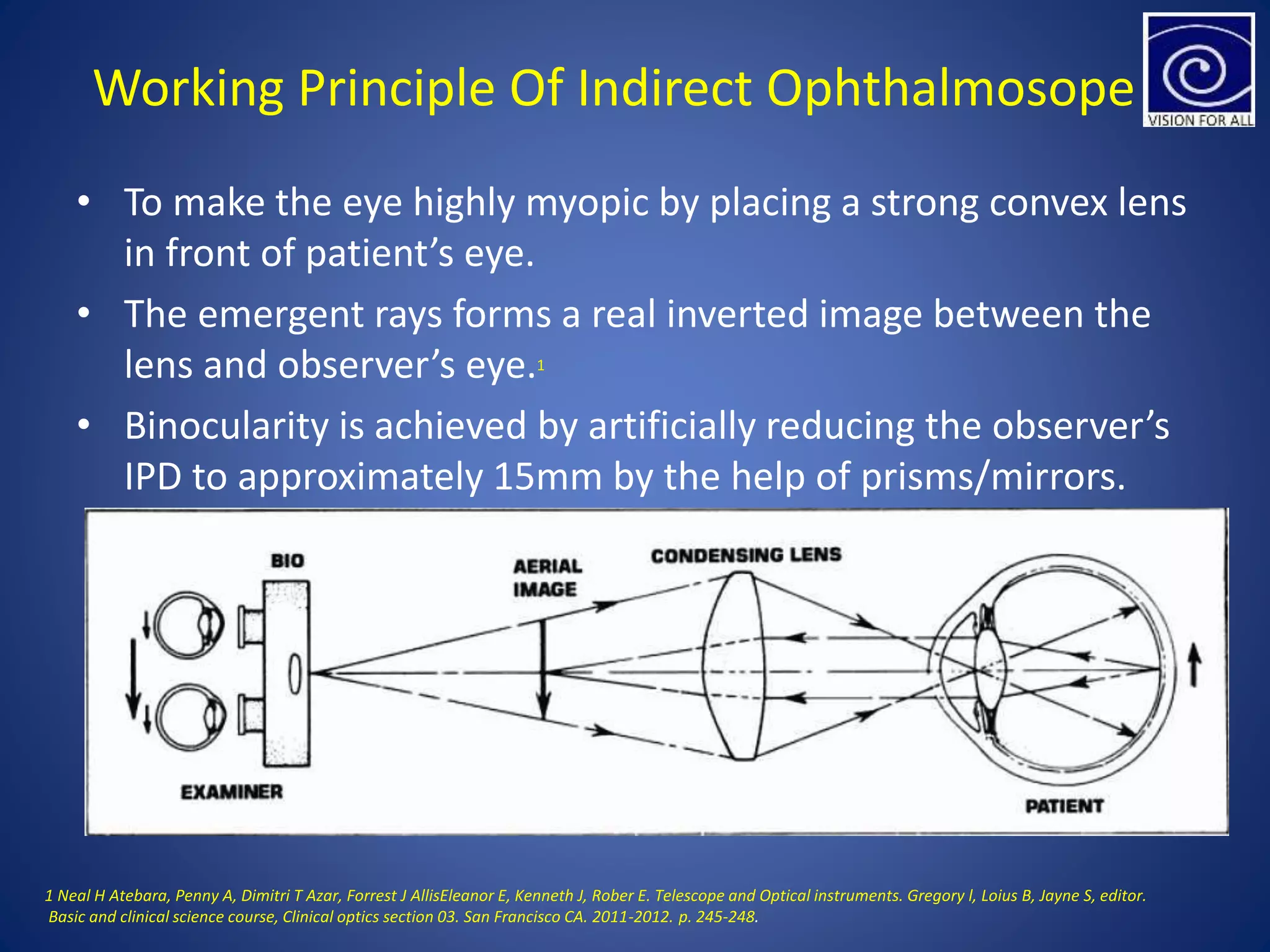 Indirect ophthalmoscopy and fundus drawing | PPTX
