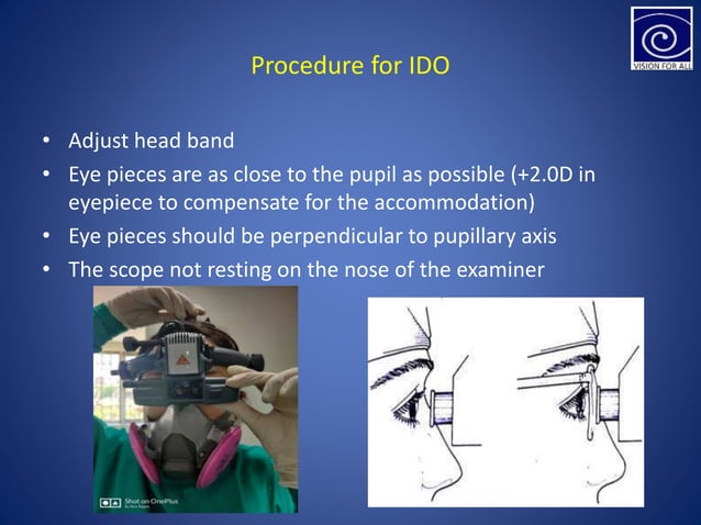 Indirect ophthalmoscopy and fundus drawing | PPTX | Eye and Vision ...