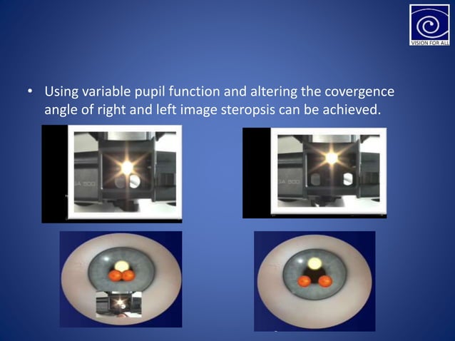 Indirect ophthalmoscopy and fundus drawing | PPTX | Eye and Vision ...