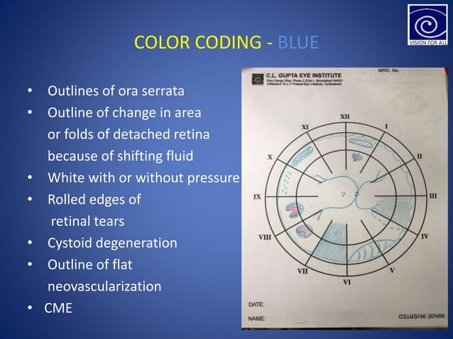 Indirect ophthalmoscopy and fundus drawing | PPTX | Eye and Vision ...