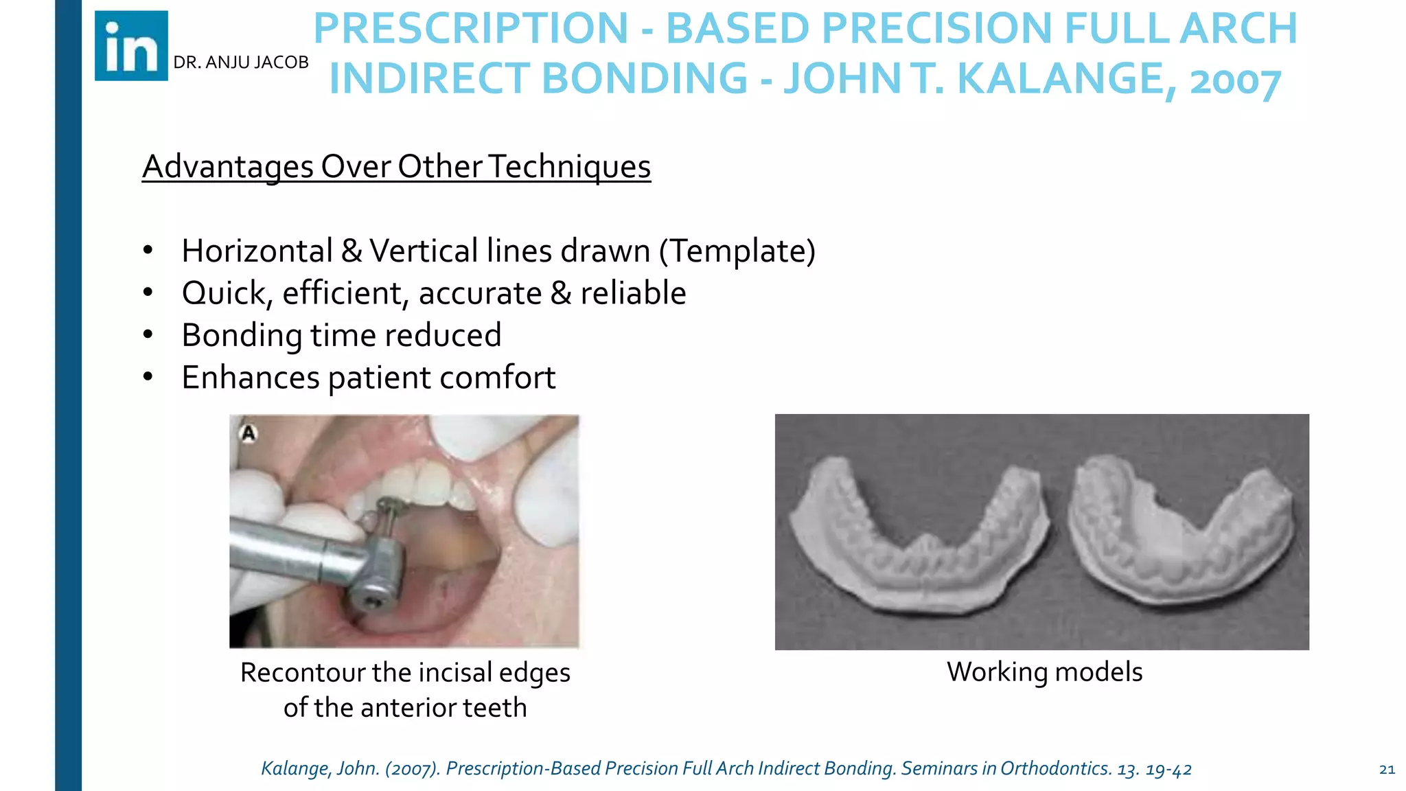 Indirect Bonding in Orthodontics | PPTX
