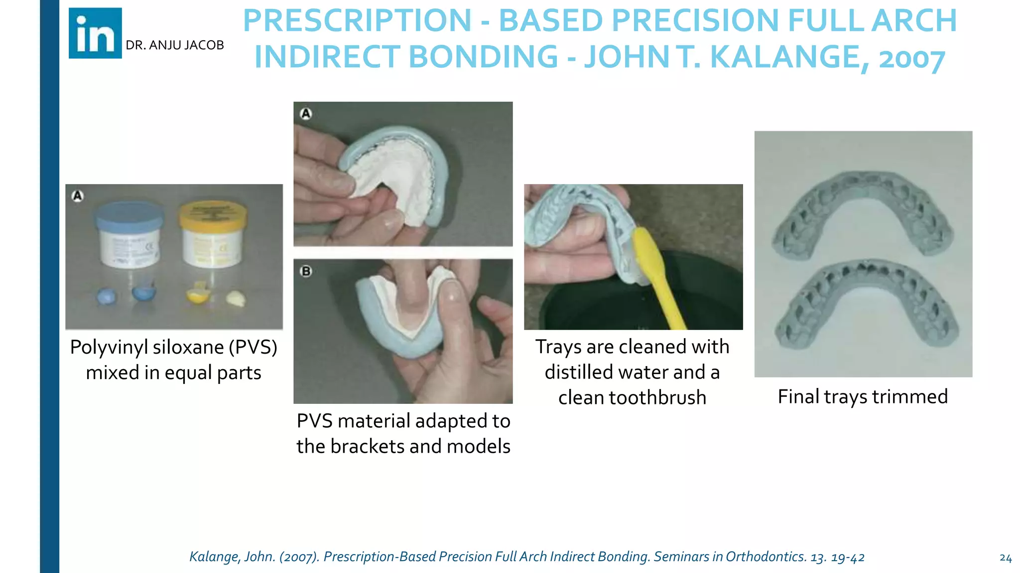 Indirect Bonding in Orthodontics | PPTX