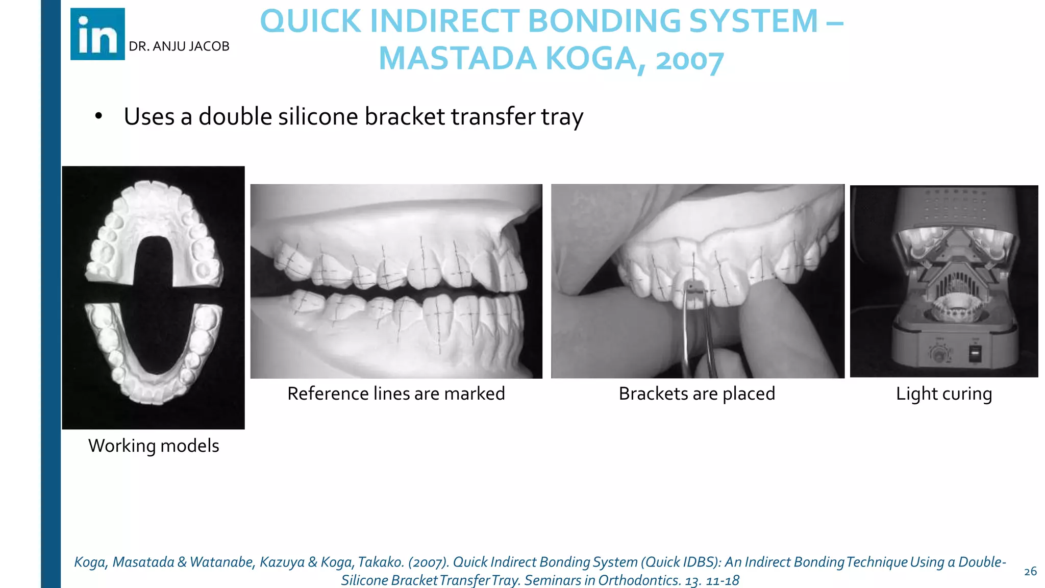 Indirect Bonding in Orthodontics | PPTX
