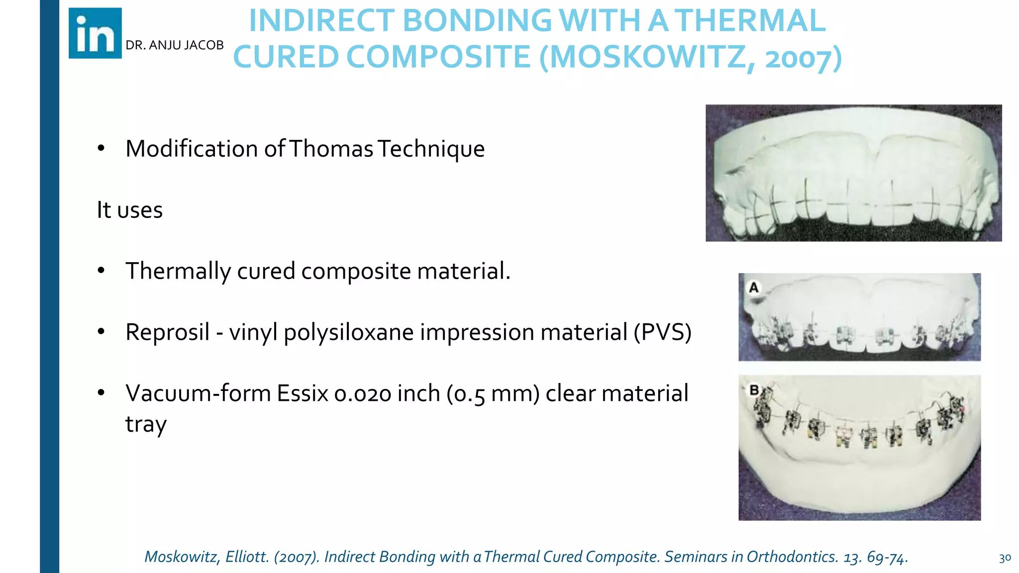 Indirect Bonding in Orthodontics | PPTX