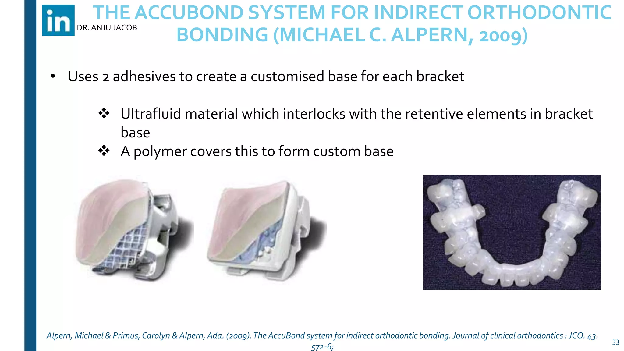 Indirect Bonding in Orthodontics | PPTX