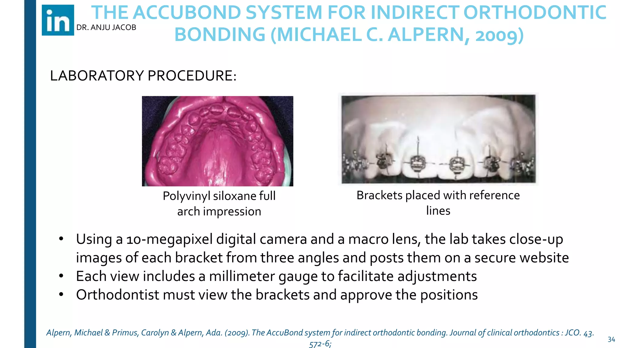 Indirect Bonding in Orthodontics | PPTX
