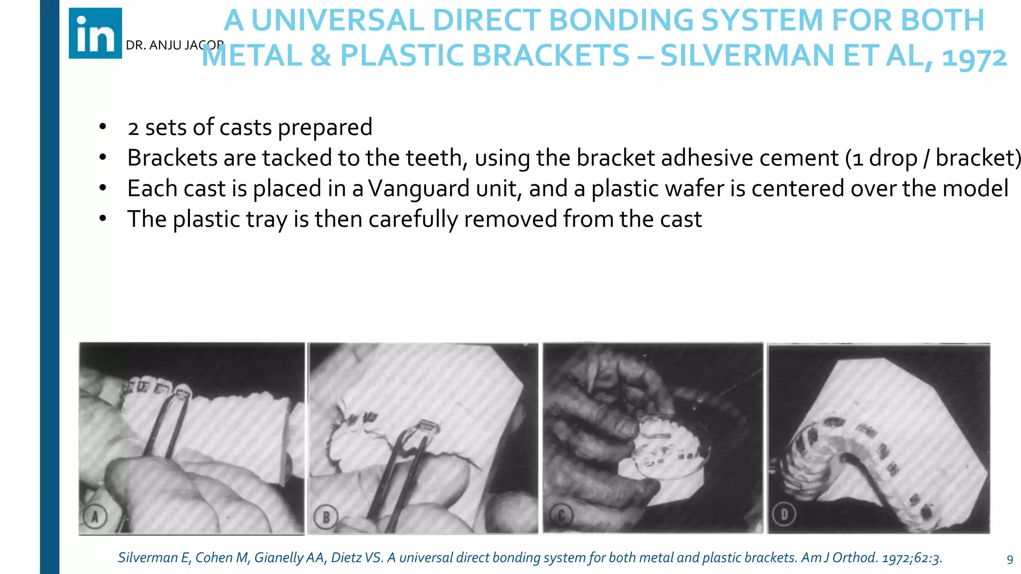 Indirect Bonding in Orthodontics | PPTX