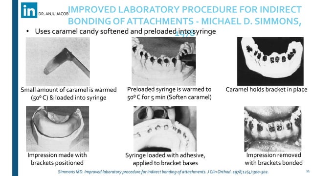 Indirect Bonding in Orthodontics | PPTX